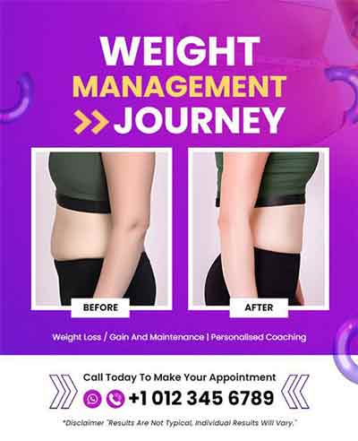 Weight Loss Flyer Templates – Free | Editable | Downloadable